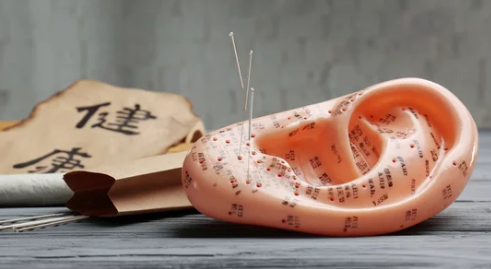 Ear Acupuncture – Acupuncture & Massage