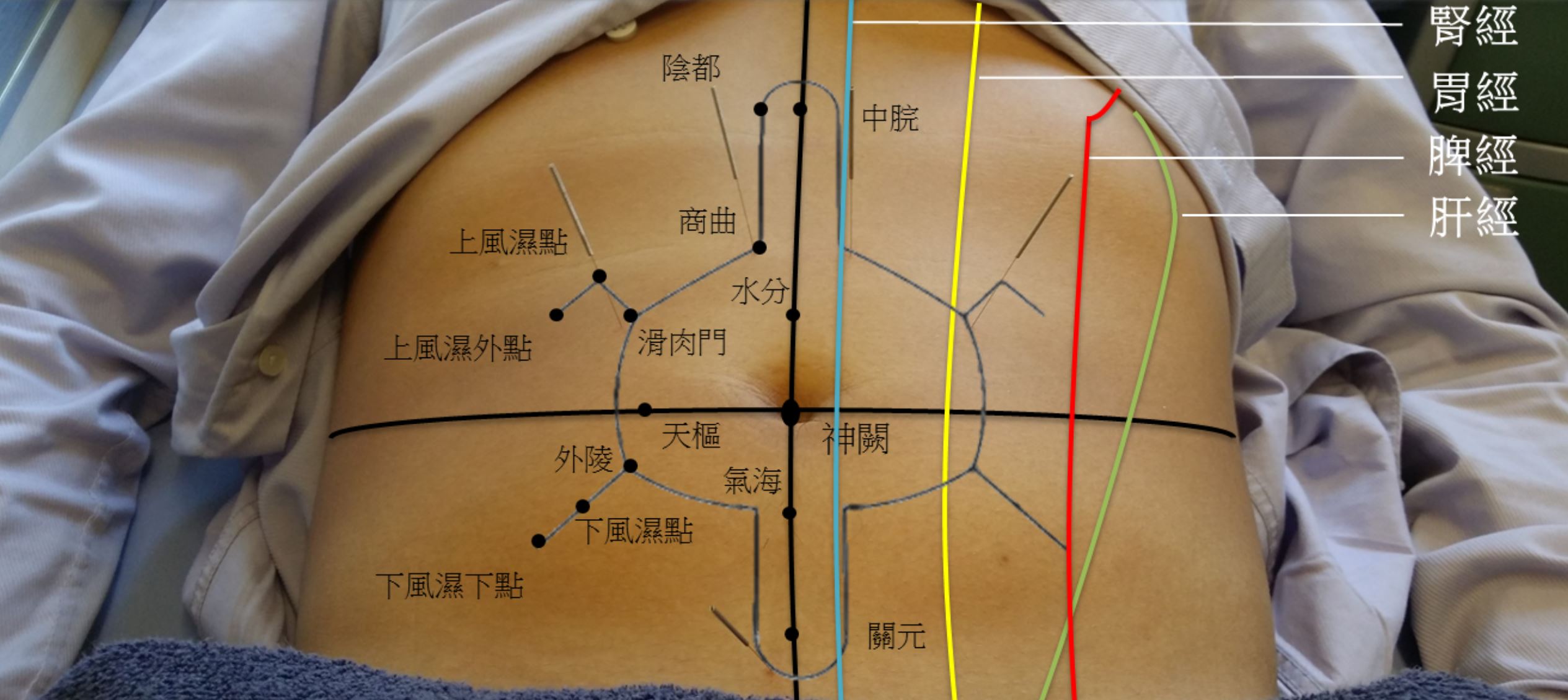 Sources – Acupuncture & Massage